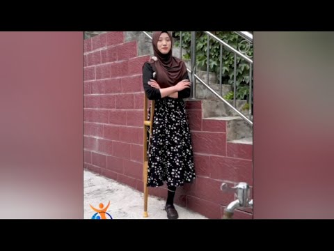 The beautiful amputee woman, a disability challenge, walks on one leg ...