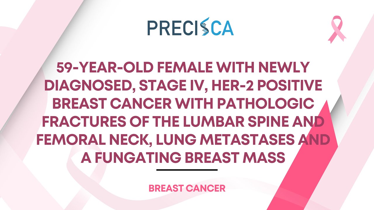 Expert Cancer Panel: Stage IV HER2+ IDC w/ fungating breast mass, lung ...