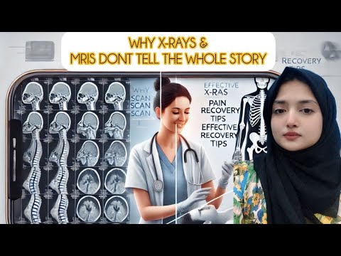 Why X-Rays & MRIs Don’t Tell the Whole Story: Effective Pain Recovery ...