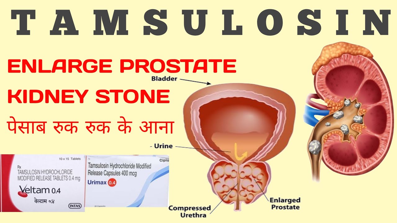 Tamsulosin Expert Shares Top Tablet Uses and Side Effects! - YouTube