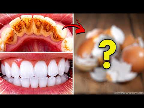 Dentists HIDE This! Whiten Teeth and Remove Tartar in 2 Mins 🦷✨