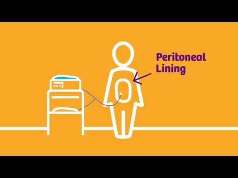 Peritoneal Dialysis Process - YouTube
