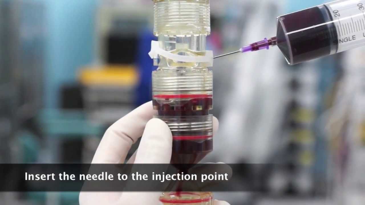 Platelet rich plasma tricell ( PRP ) - YouTube