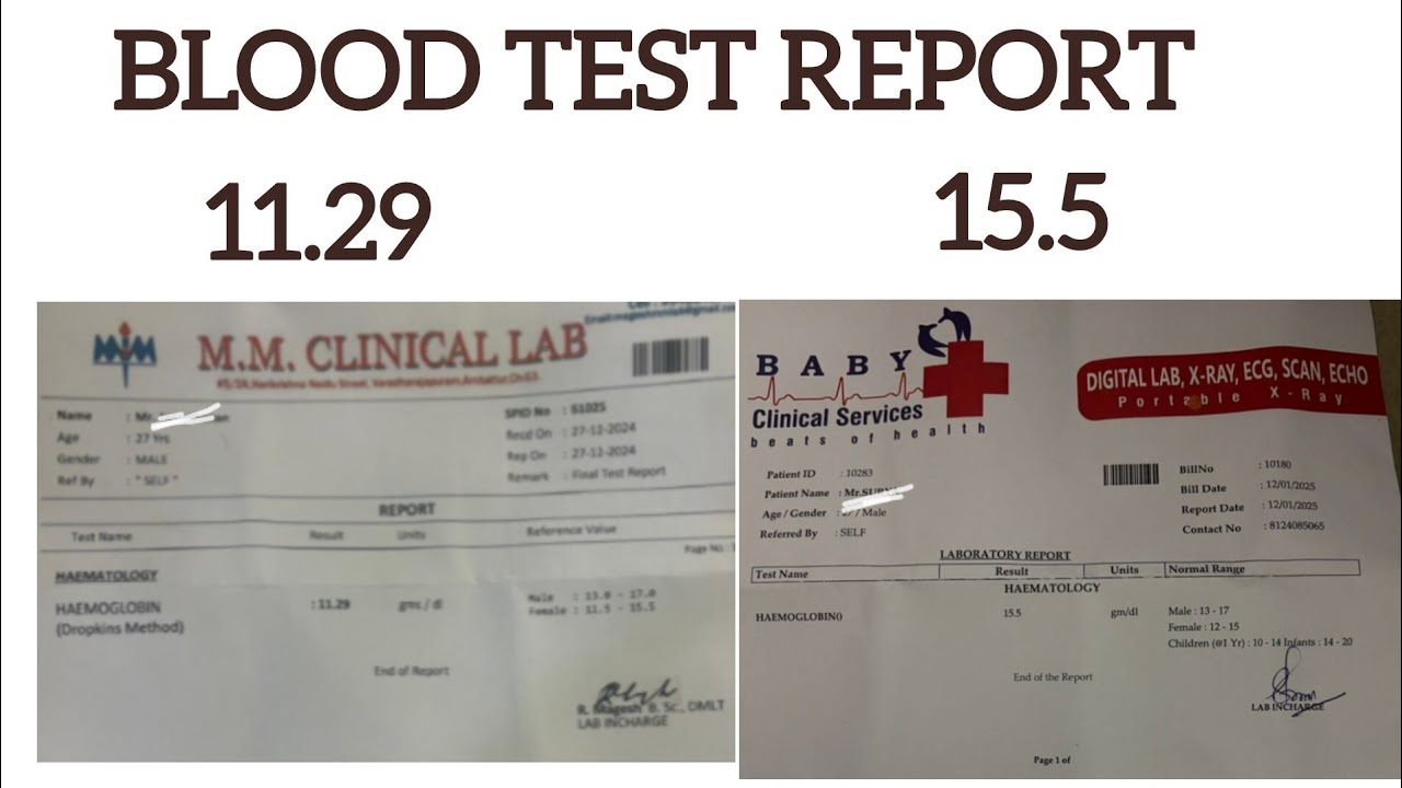 HSV | blood test report Dr. Sundar Rajan 9840981014 - YouTube