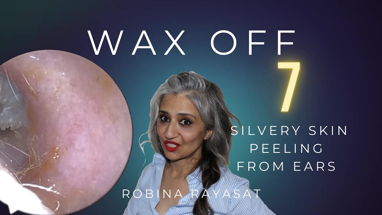Silvery Skin Peeling from Ears | Wax Off - Episode 7 - YouTube