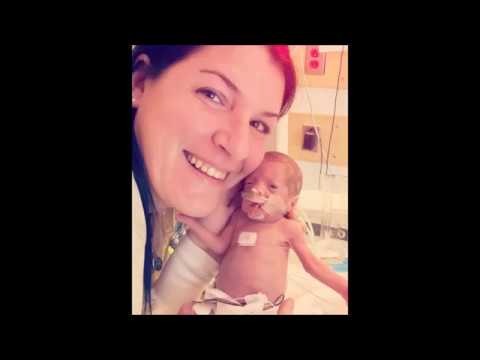A 25 weeker's first year of life - Maggie Jo - YouTube