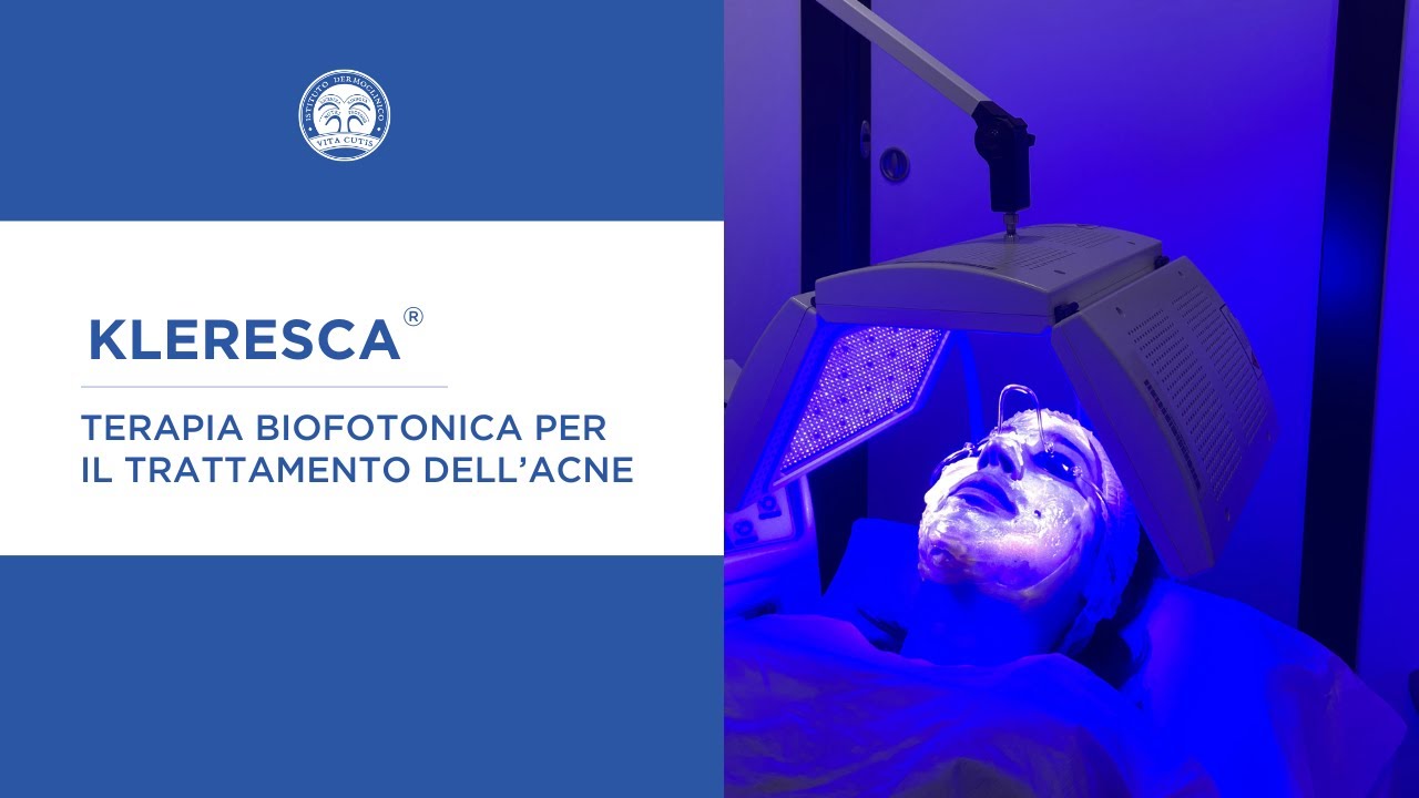 Kleresca®: terapia biofotonica per il trattamento dell'acne - YouTube