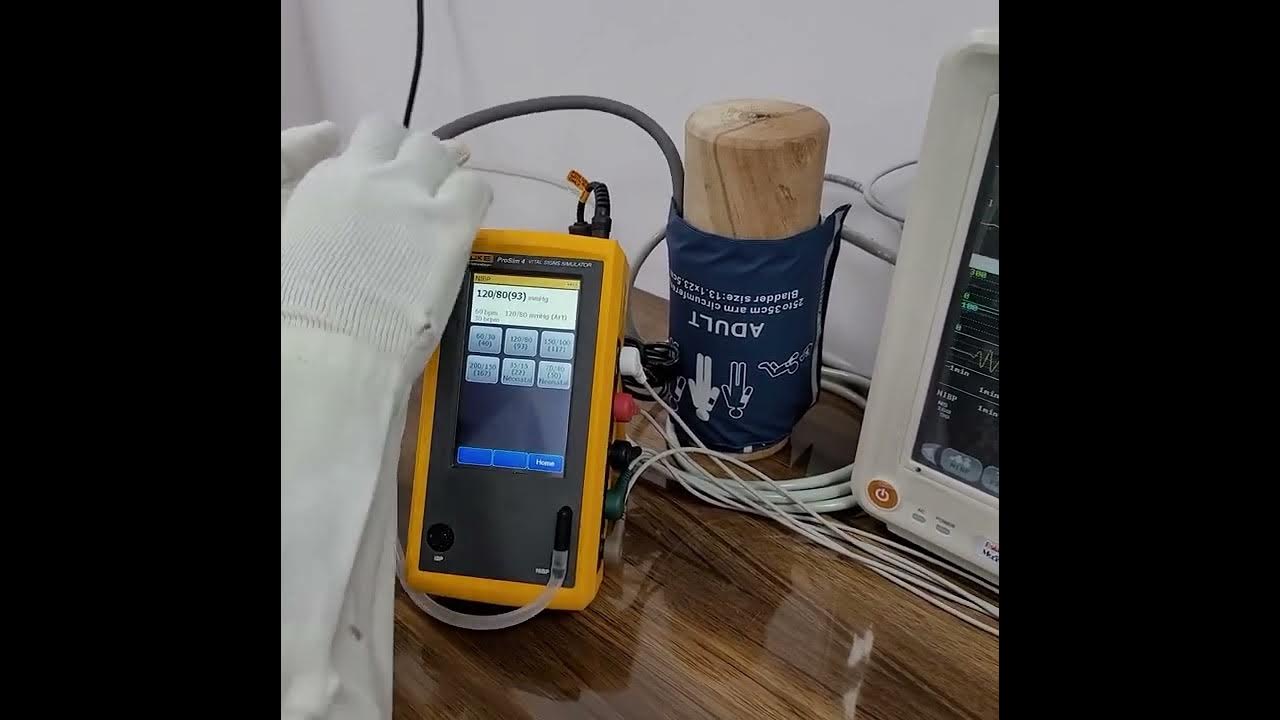 BLOOD PRESSURE ( NIBP ) CALIBRATION IN PATEINT MONITOR BY VITAL/NIBP ...