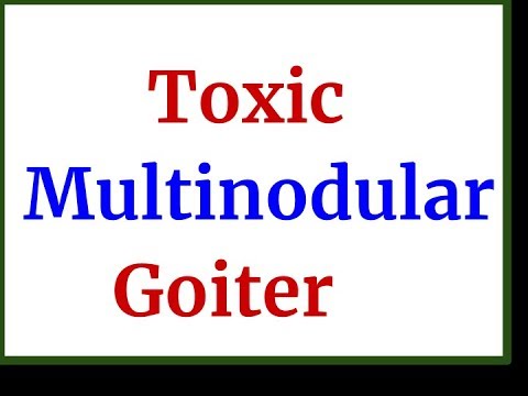 Toxic Multinodular Goiter - YouTube