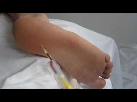 Heel injection - YouTube