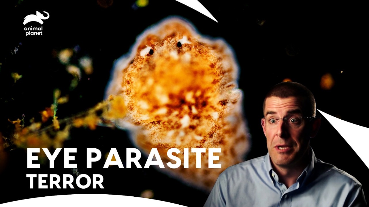 Will Doctors Save Whitney’s Eye From Parasite Infection? | Monsters ...