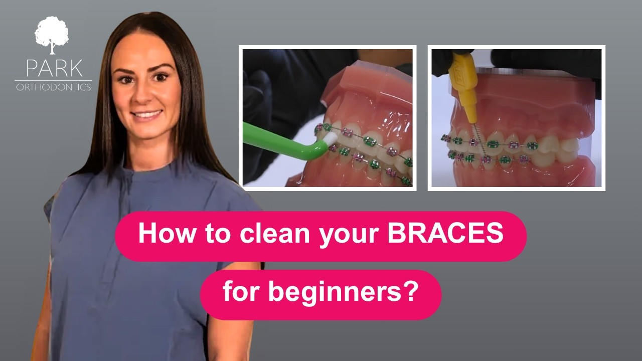 How to clean your BRACES for beginners? - YouTube