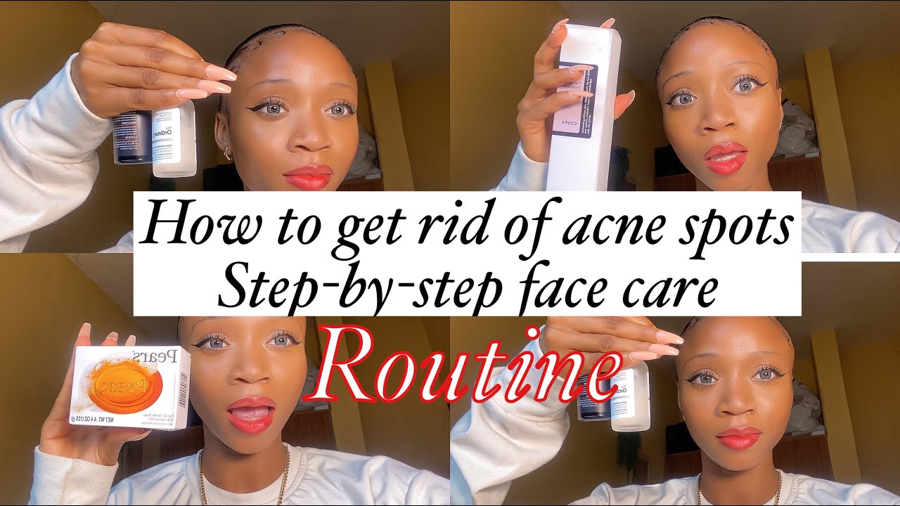 How To Get Rid Of Dark Acne Spots Face Care Step By Step Routine how-to-get-rid-of-dark-acne-spots-face-care-step-by-step-routine
