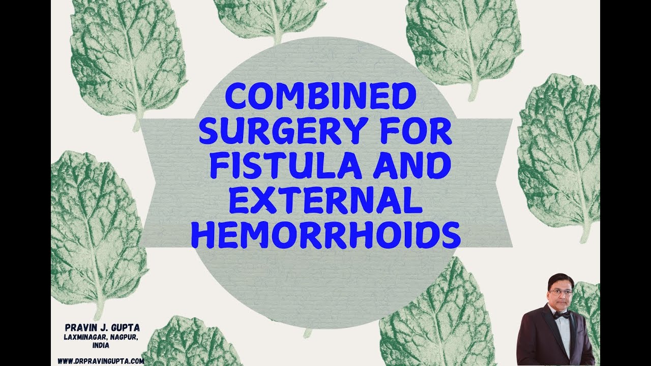 COMBINED SURGERY FOR FISTULA AND EXTERNAL HEMORRHOIDS - YouTube