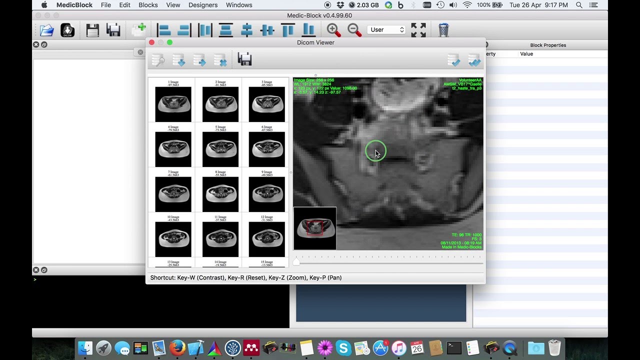 Medic-Blocks (v0.4.99.60) - DICOM folder scan - YouTube