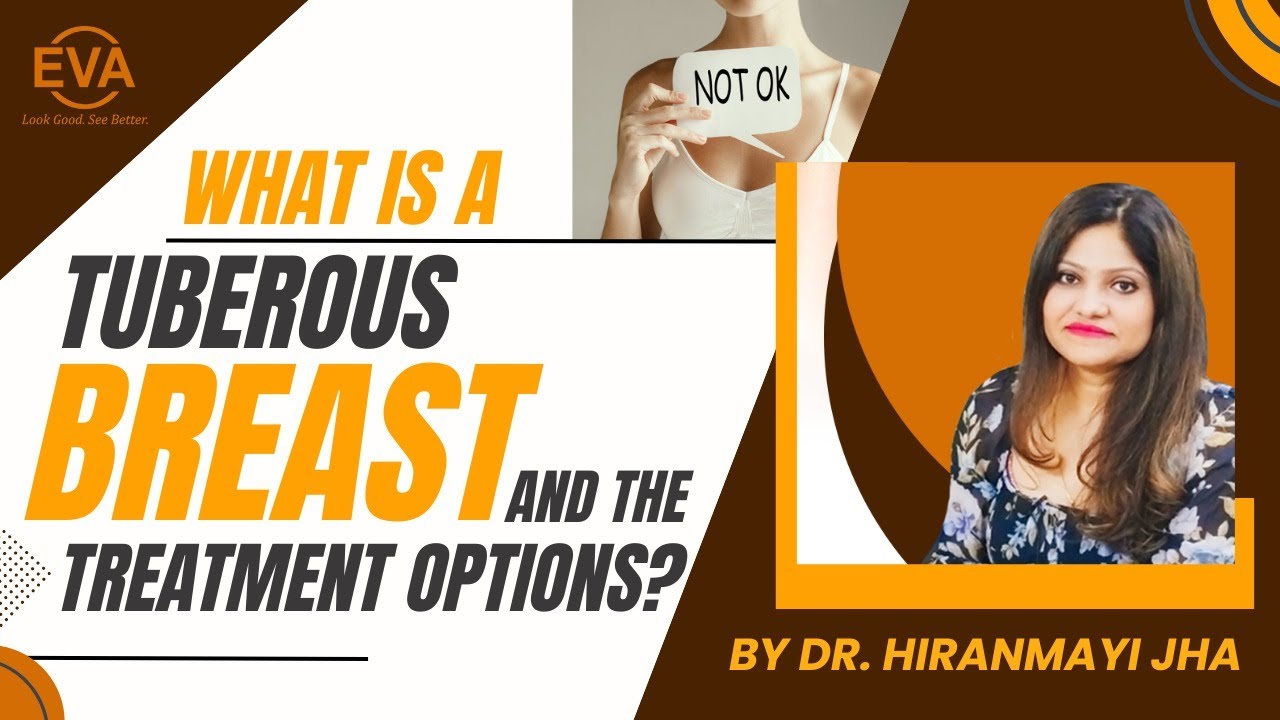 Tuberous Breast Treatment Options? Treatment for Tuberous Breasts in ...