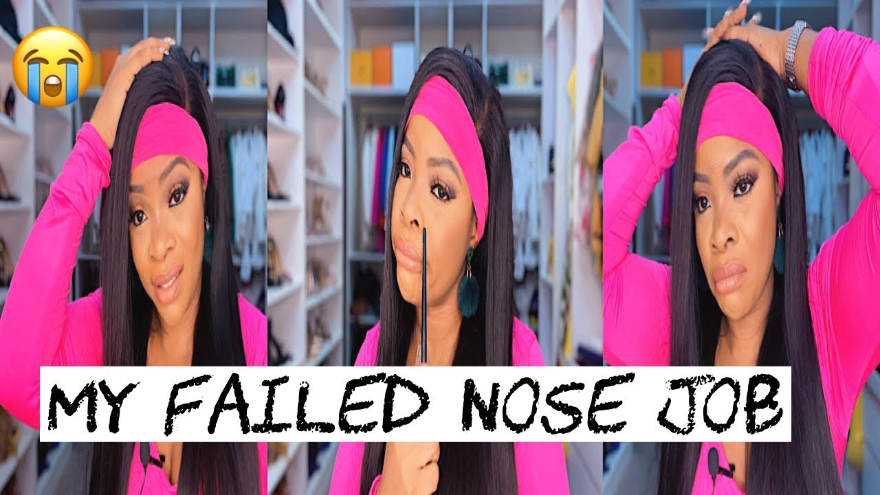 MY FAILED NOSE JOB - YouTube
