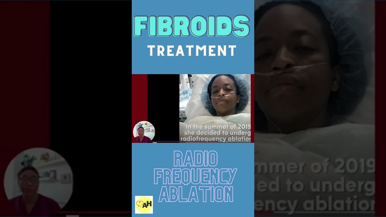 Radiofrequency Ablation For Fibroids - YouTube