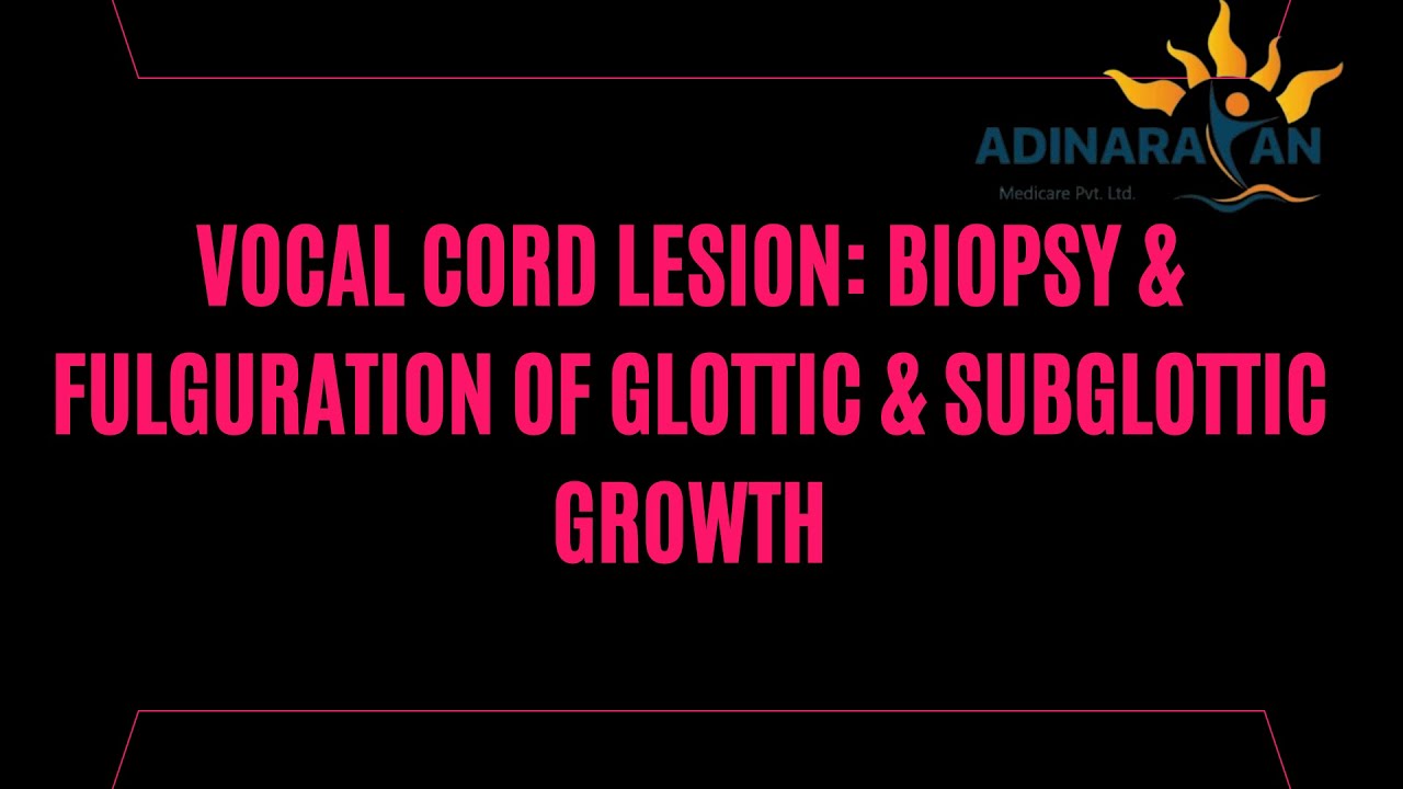 Vocal Cord Lesion Biopsy & Fulguration of Glottic & Subglottic Growth ...