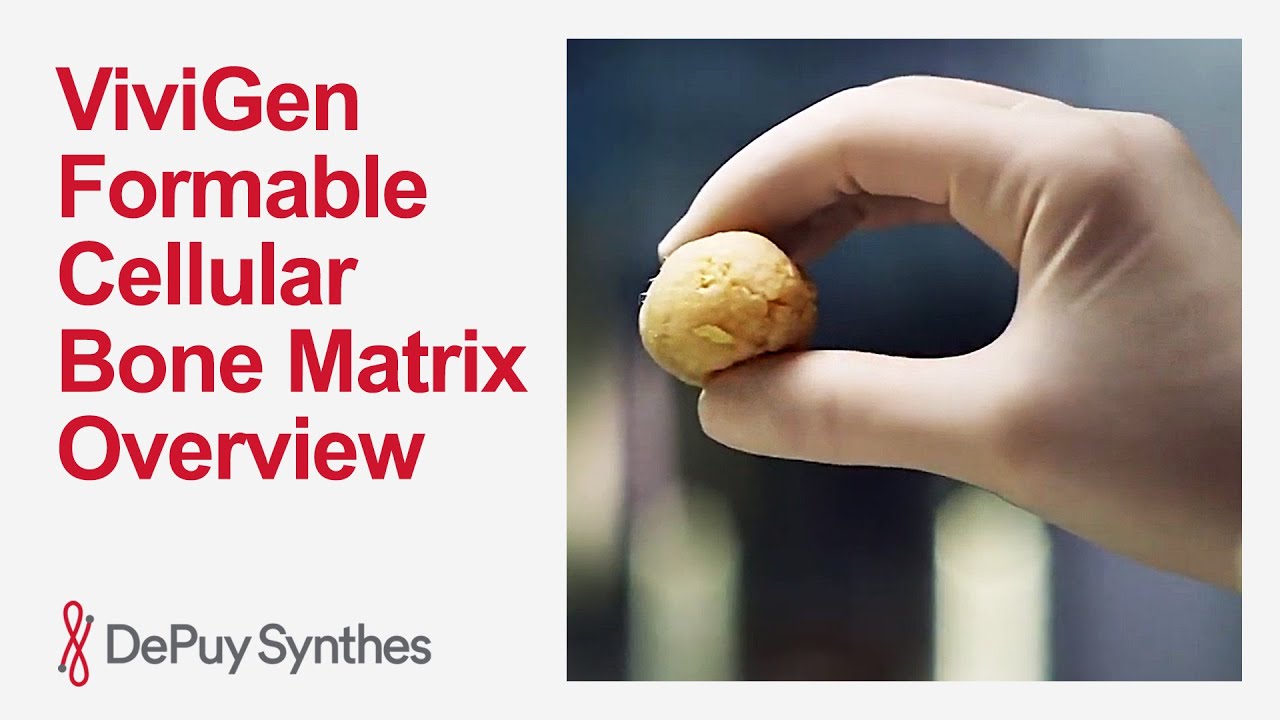 ViviGen Formable Cellular Bone Matrix: Features and Benefits | DePuy ...