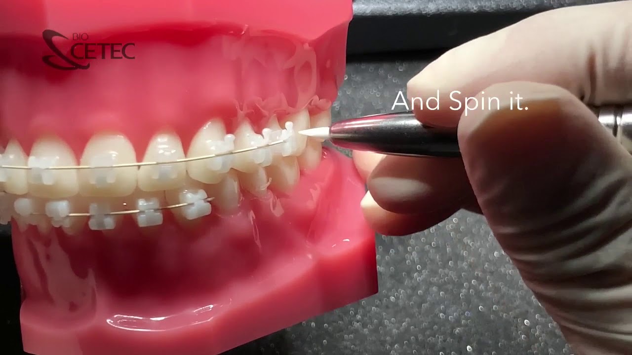 S-Line opening method with SL- OT- 3 - YouTube