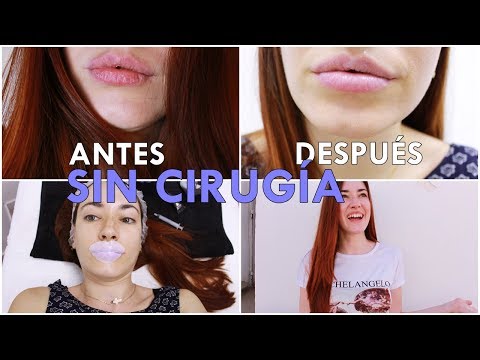 Ciencia de ti: Labios nuevos con dermapen y láser diodo en Clinic&Esthetic