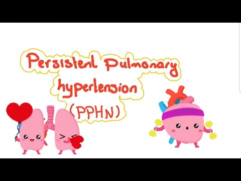 Persistent pulmonary hypertension (PPHN) in neonates - YouTube