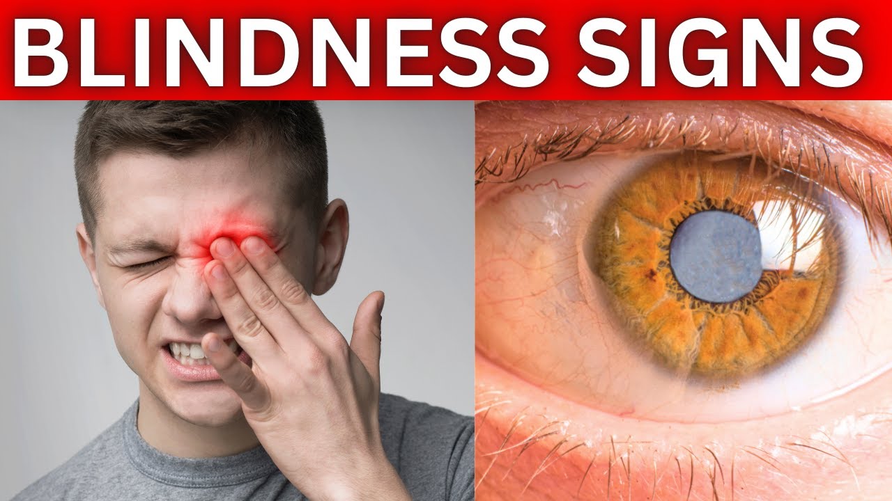 12 Early Signs of Blindness - YouTube