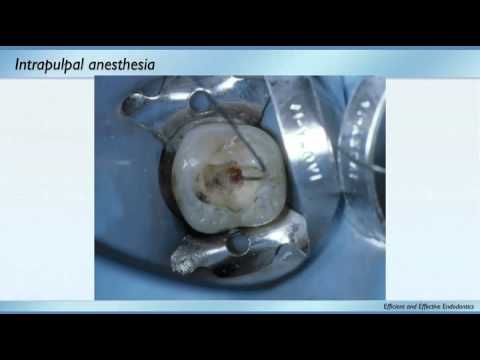 Anesthesia and Rubber Dams - Dr. Diwakar Kinra | Dentsply Sirona - YouTube