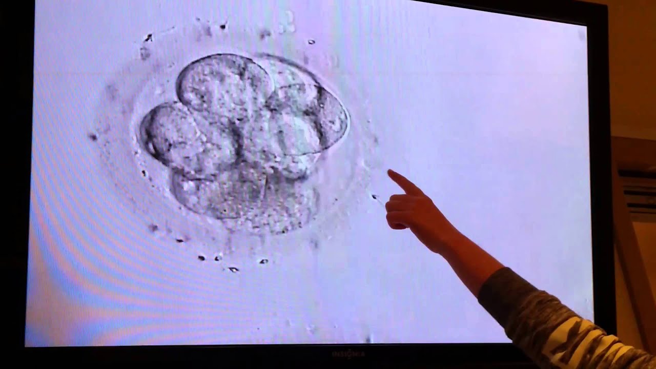 Laser-Assisted Embryo Hatching - YouTube