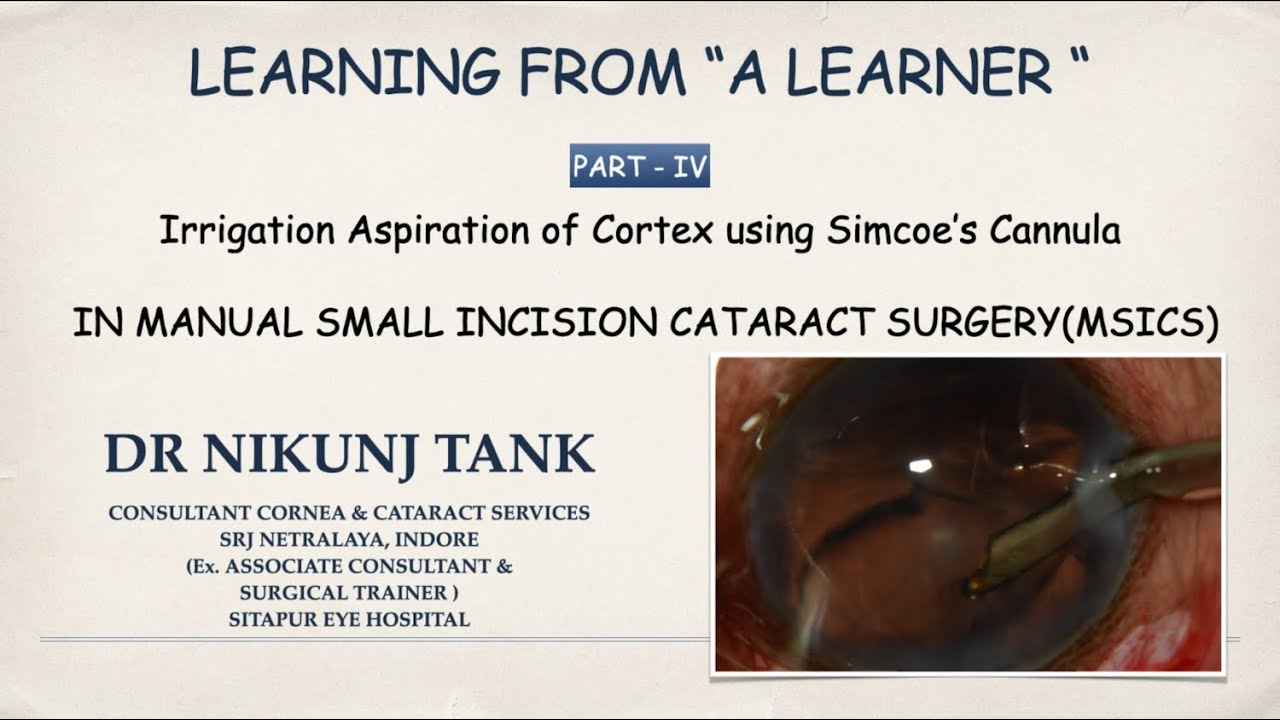 Learning from "a Learner" Part 4- Irrigation Aspiration of the cortex ...