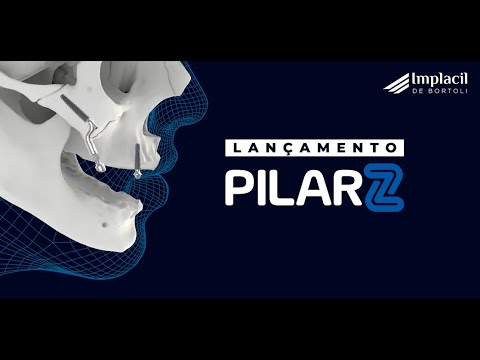 Montagem do Pilar Z - YouTube