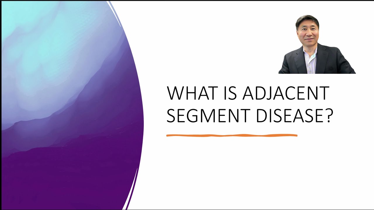 Adjacent Segment disease - YouTube