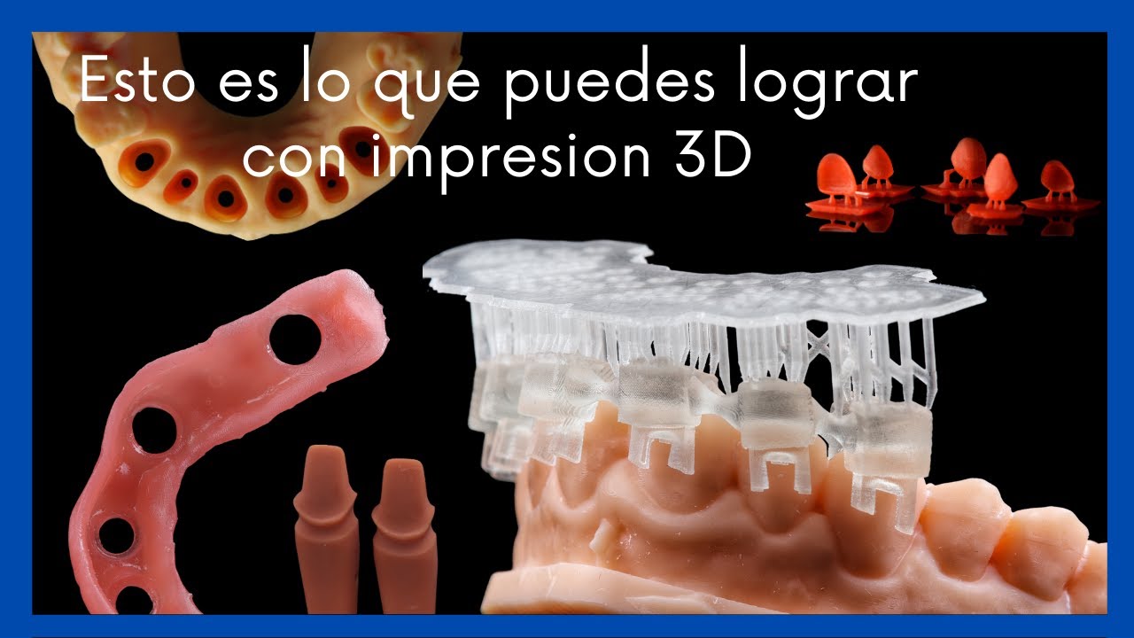 Esto es lo que puedes lograr con la impresion 3D en Odontologia! - YouTube