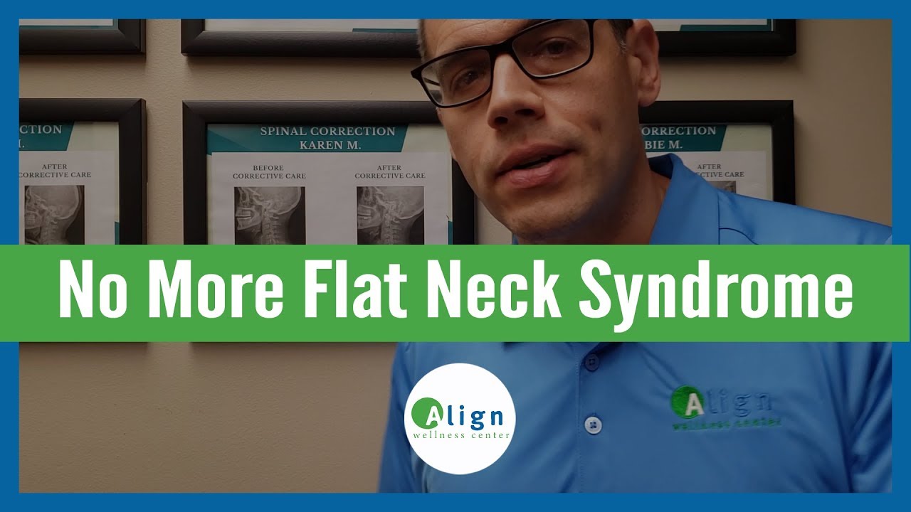 Flat Neck Syndrome Treatment | Trouble Sleeping and Working Out? - YouTube
