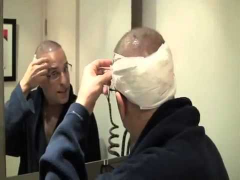 Simon Withington, DHI Hair Restoration, Step by Step #1 YouTube - YouTube