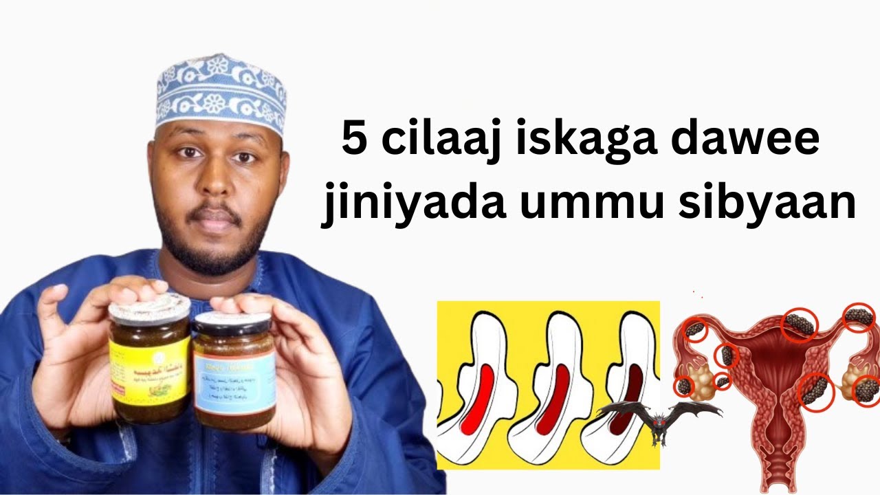 5 cilaaj iskaga dawee ummu sibyaan jinniyada ilmaha soo ridaysa - YouTube
