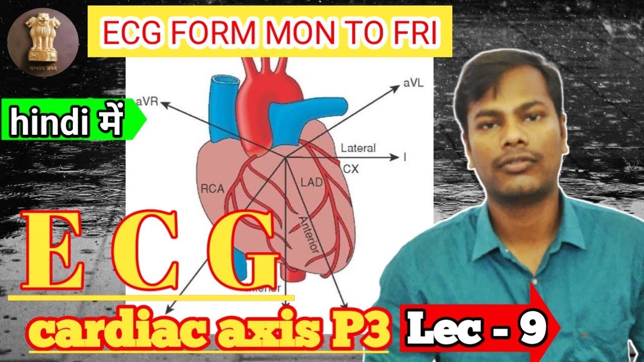 cardiac axis part 3| lecture 9| ECG axis| QRS angle ...