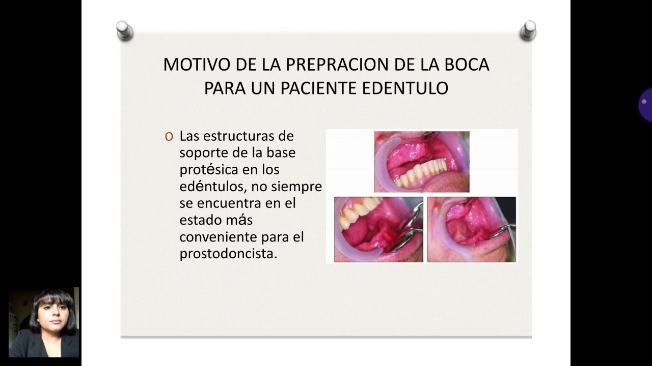PREPARACIÓN DE LA BOCA EN UN PACIENTE EDENTULO - YouTube