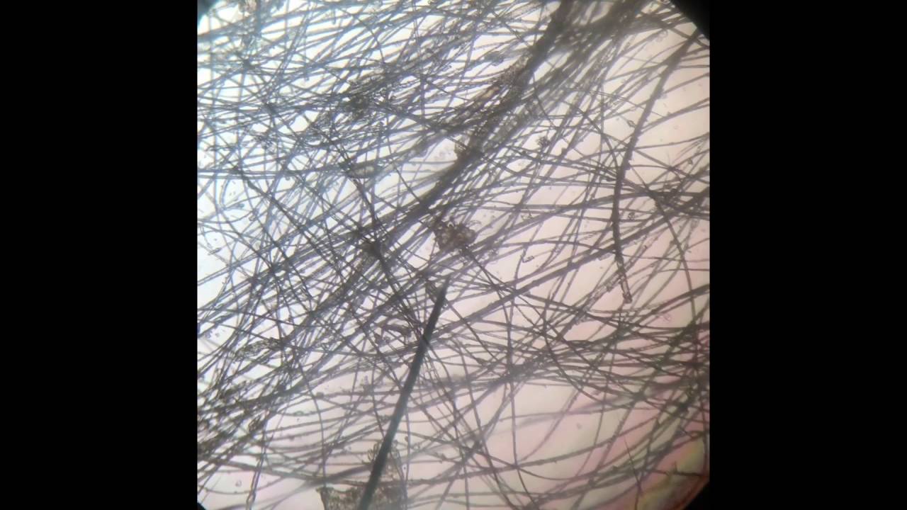 Myobia musculi - YouTube