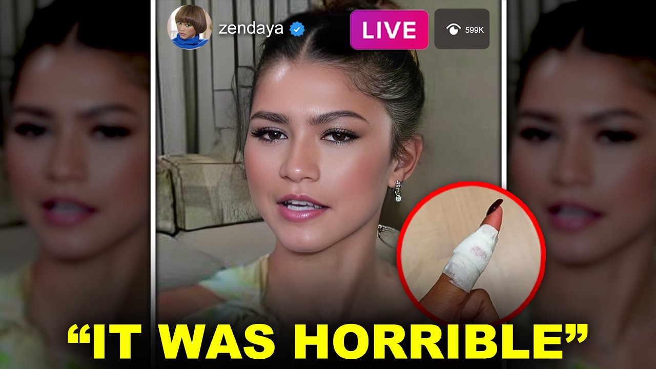 "It Was Brutal" Zendaya Reveals Why She Had To Go To The Hospital ...