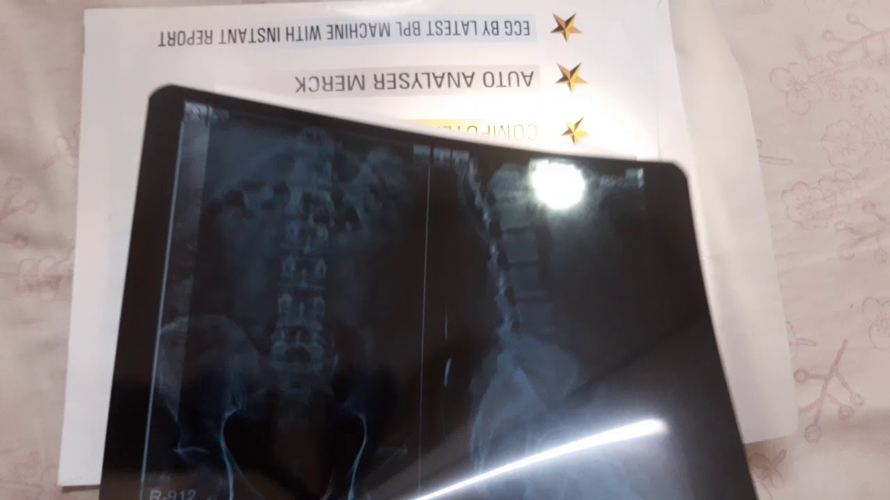 Back pen L4 x-ray - YouTube