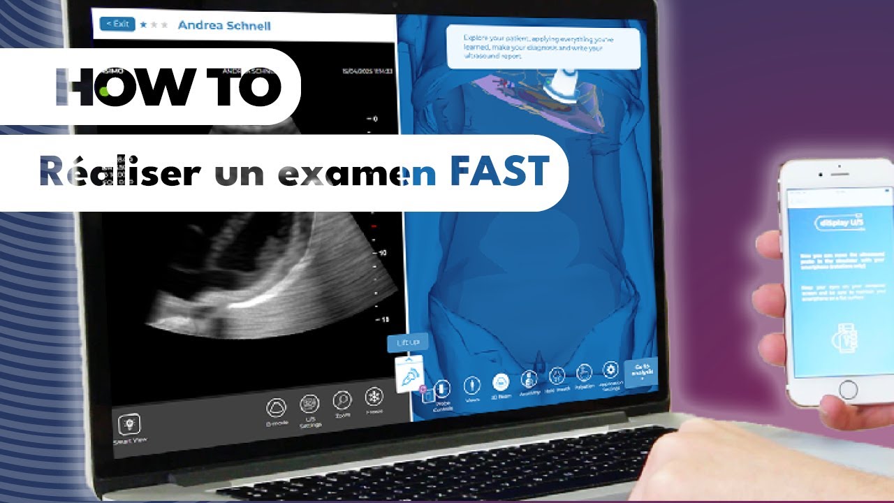 Comment réaliser un examen FAST dans le simulateur d'échographie ...