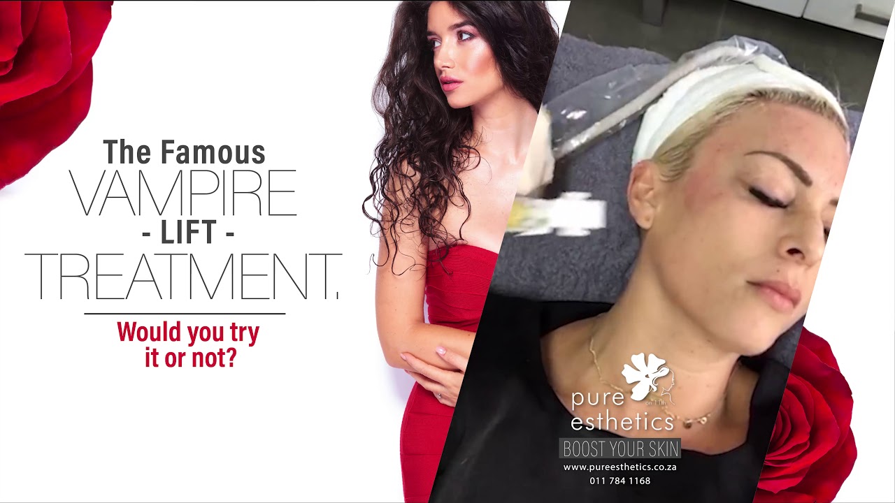 Vampire Lift with PRP - YouTube