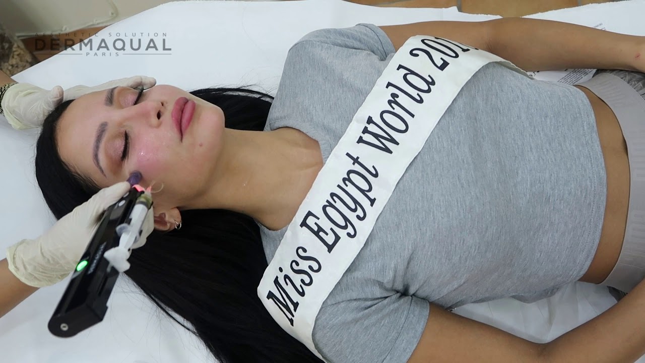 DERMAQUAL FORZA MMS 007 ASCORBIX20 ANTIOXIDANT MESOTHERAPY FOR MISS ...