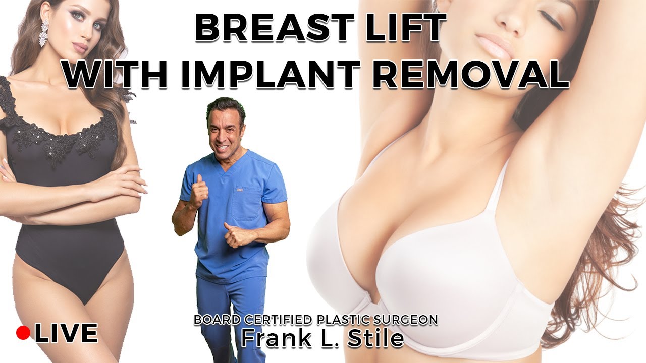 Live Breast Lift With Implant Explantation Mastopexy Youtube