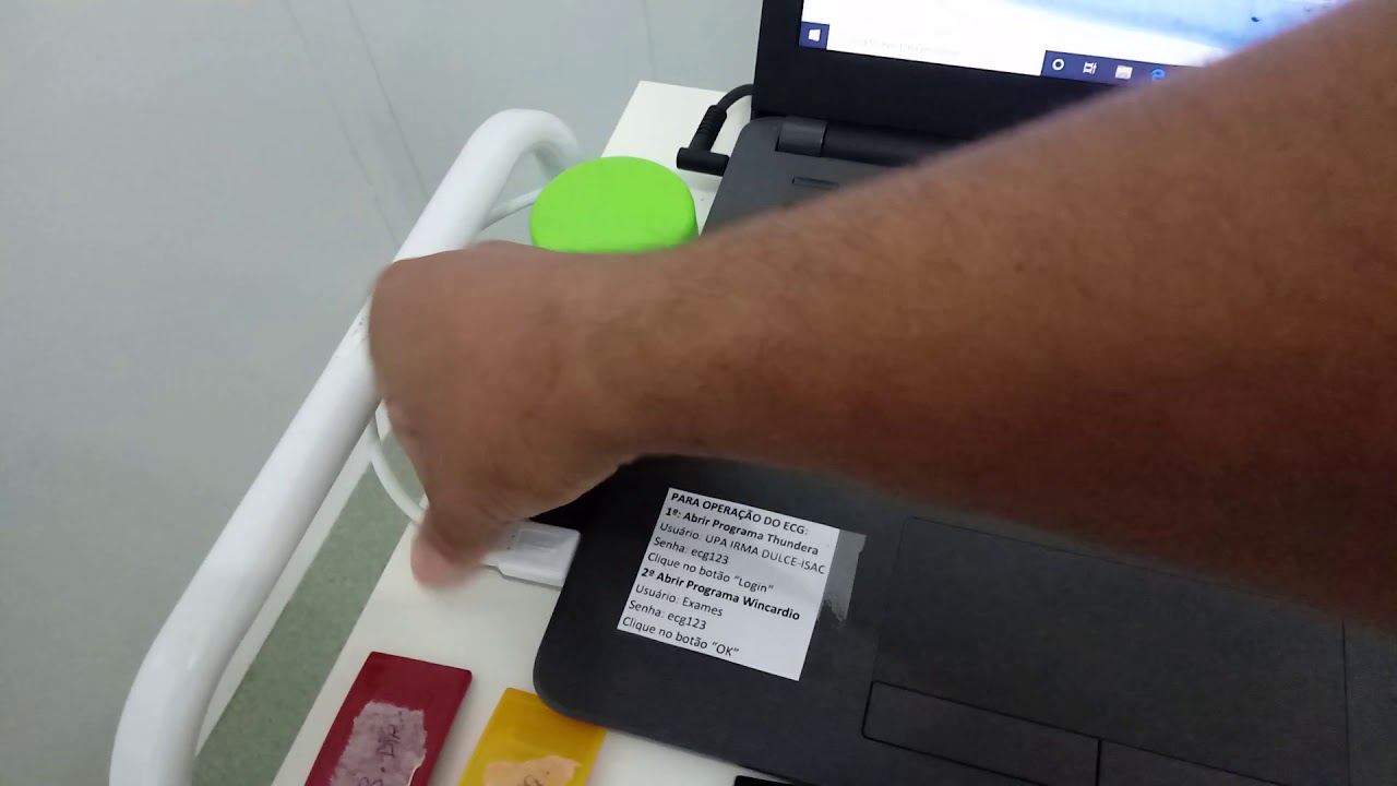 Operação - ECG Wincardio Telecardio - YouTube