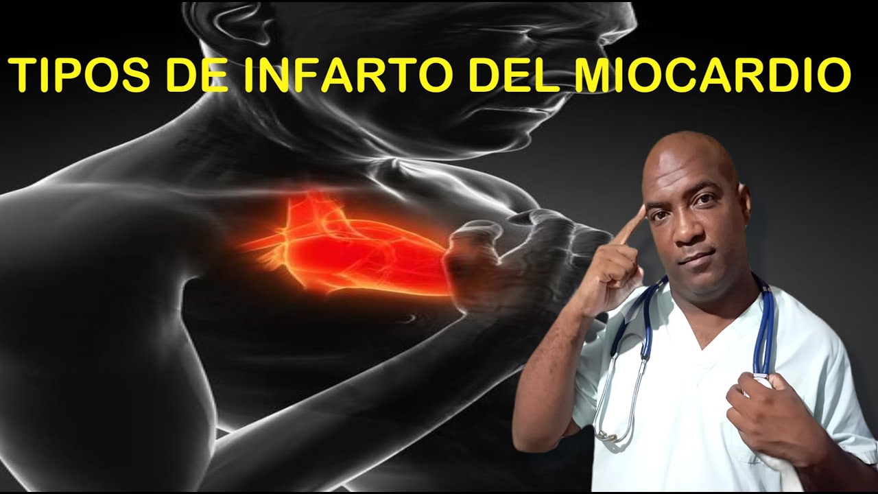 Tipos de Infarto del Miocardio - YouTube