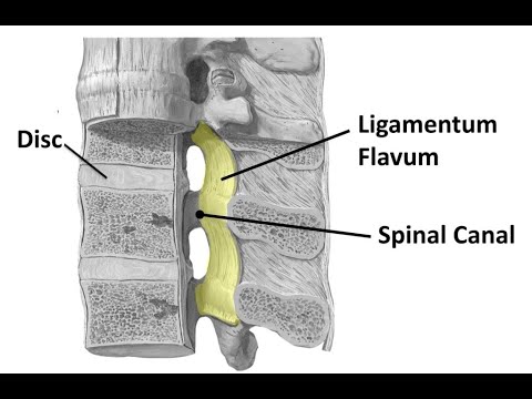 Anatomy of the Ligamentum Flavum - YouTube