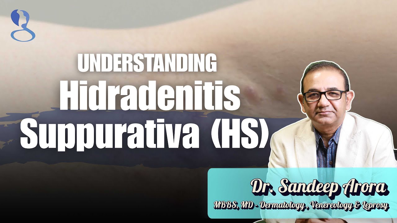 Understanding Hidradenitis Suppurativa (HS) – Causes, Symptoms ...